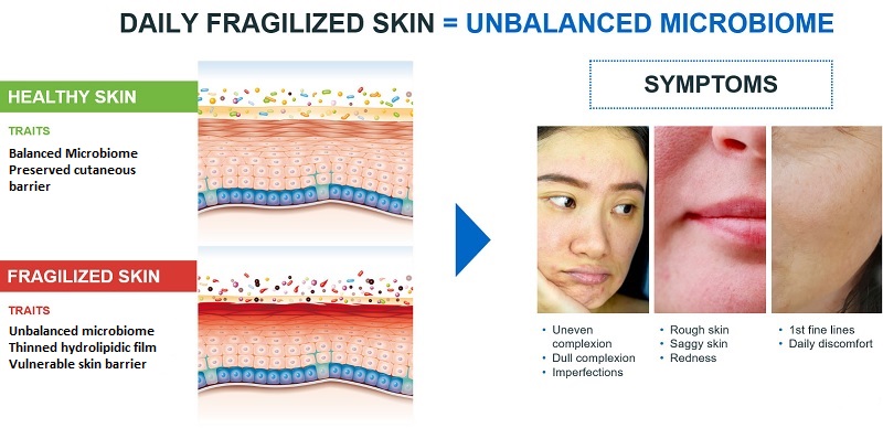 Dry Skin - Articles | Dis-Chem